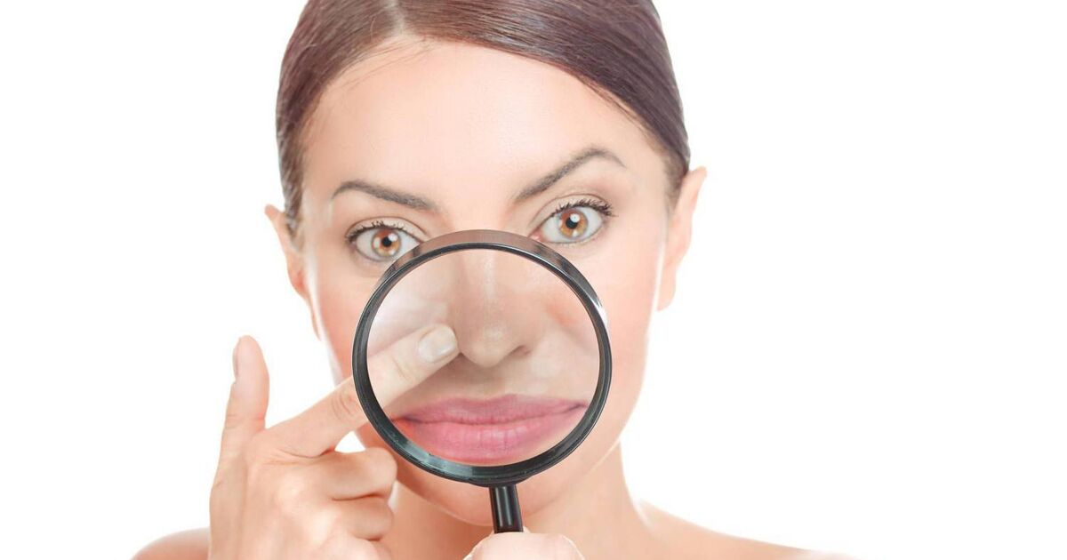 The Skin Nerd: Let's start the conversation about acne