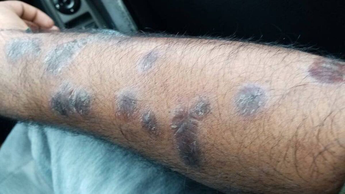 Residents suffering from skin complaints and cockroaches found in ...