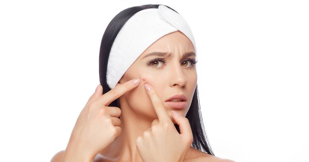 The Skin Nerd: Simple pimple... how to pop a spot