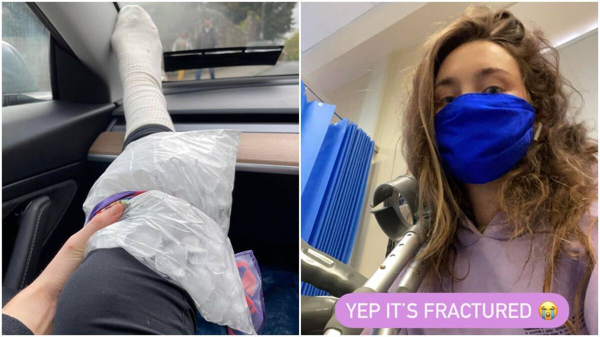 Roz Purcell suffers fractured leg in ‘freak accident’ while playing tennis