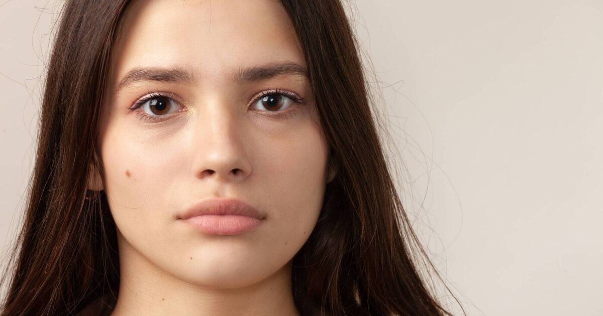 Skin Nerd: Are you taking care of your moles?