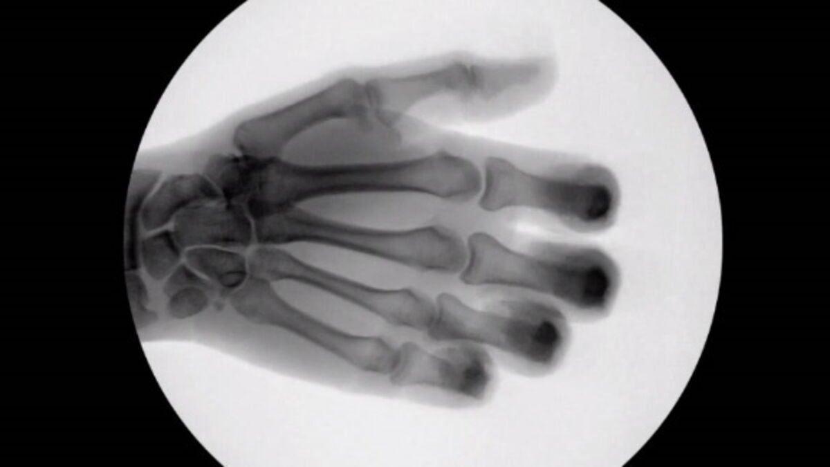 This is what your bones look like when you move