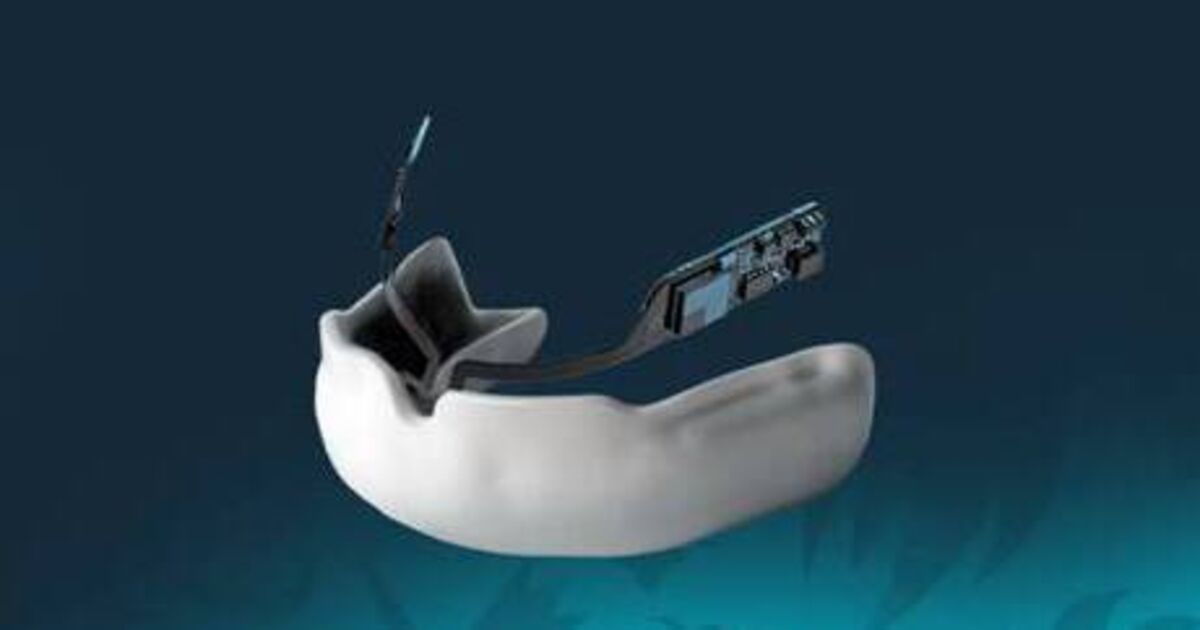 Smart Mouthguards to be worn by players in Six Nations