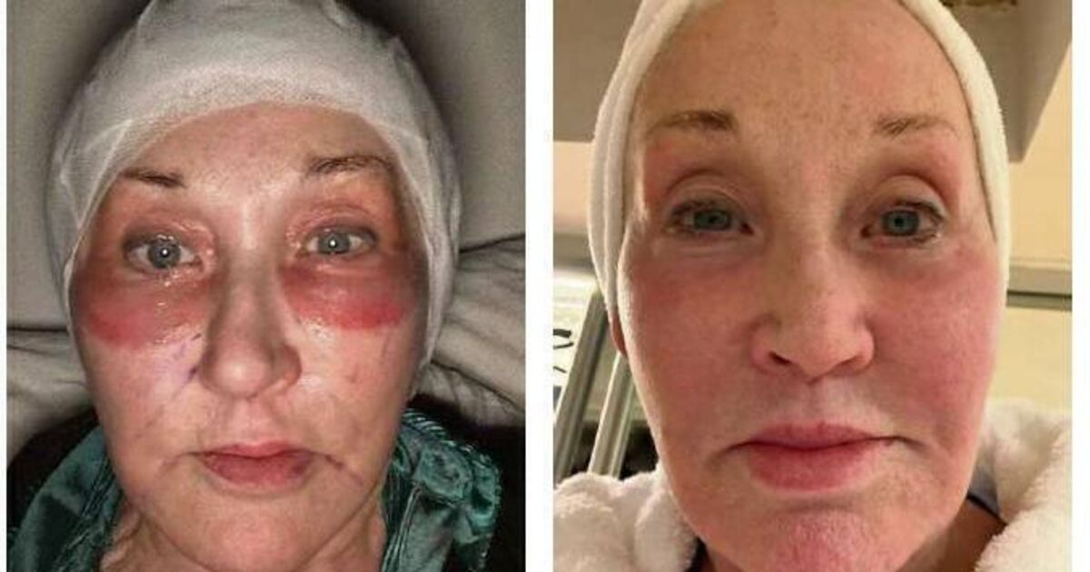 Terry Prone: Nothing wrong with ironing out creases by going under the ...