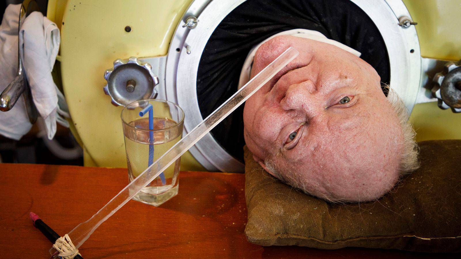 Paul Alexander, the 'man in the iron lung', dies aged 78