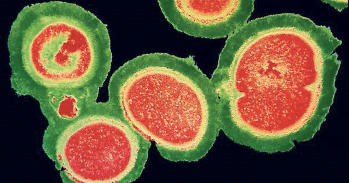 Cases of MRSA and C.difficile see sharp drop