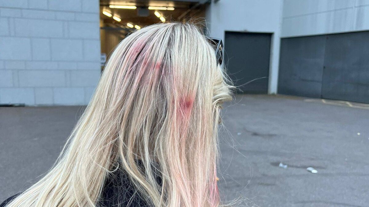 'I just felt unsafe': Woman hit with flare during Cork-Limerick match ...