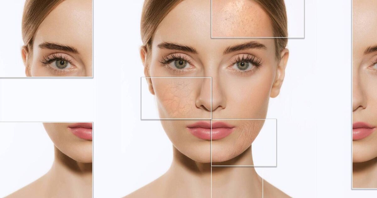The Skin Nerd: Do you have dry skin? Here's what you need to know