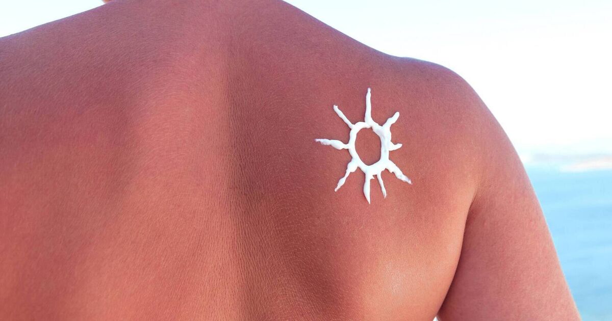 Life Hack: How to treat sunburn and help it heal as fast as possible