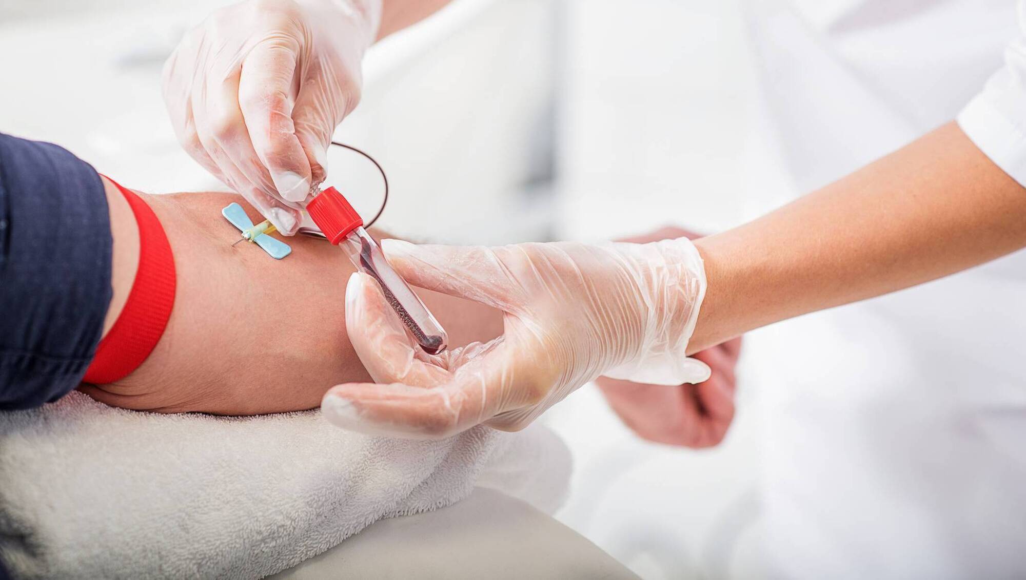 Pinprick blood test could detect disease 10 years before symptoms ...